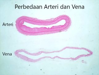 Perbedaan Arteri dan Vena pada Tubuh - Kerajaan Biologi